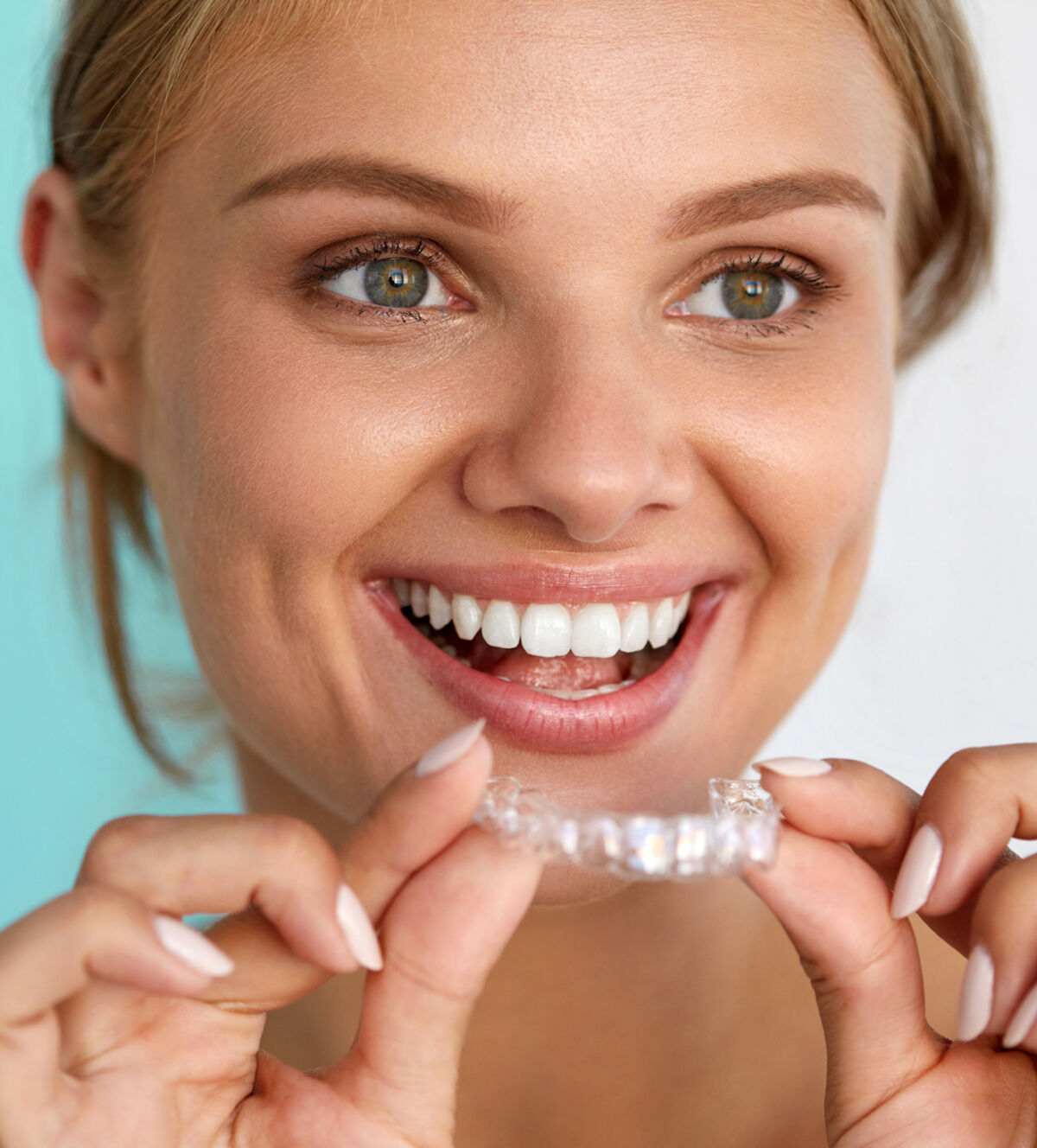 How to brighten your smile in 2023 | Chinook Dental Group